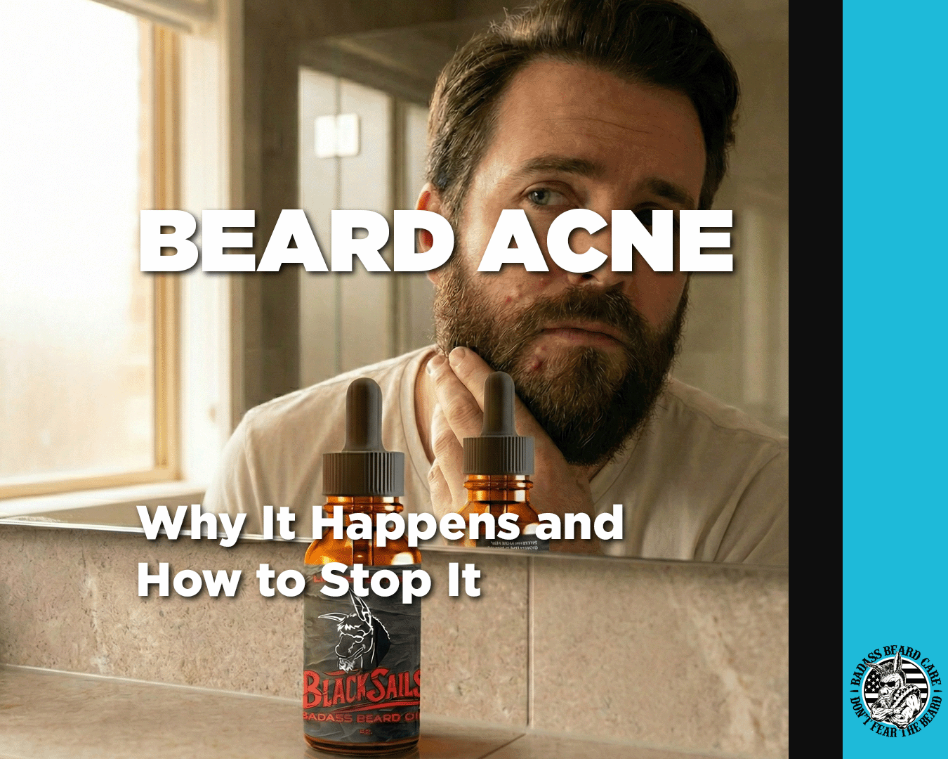 Beard Acne: Why It Happens and How to Stop It – Badass Beard Care